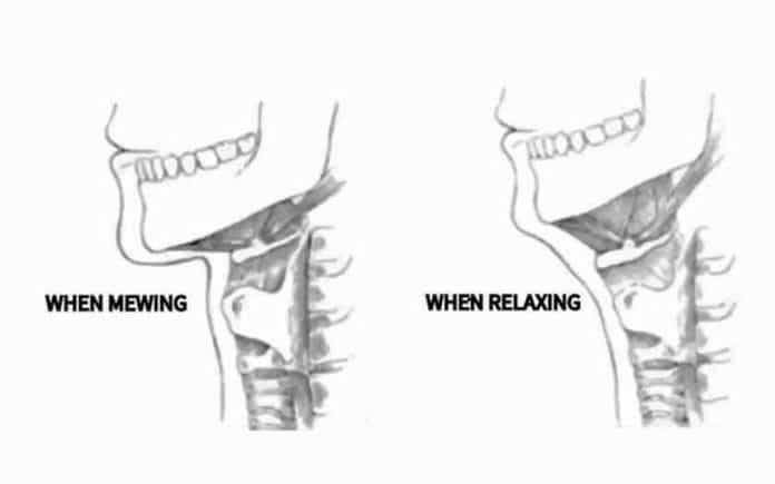 Mewing : Qu'est ce que c'est et comment ça marche ? - Young Gent