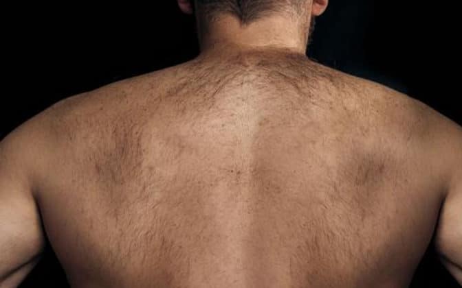 Épilation du dos pour homme : conseils, techniques, astuces et prix ...